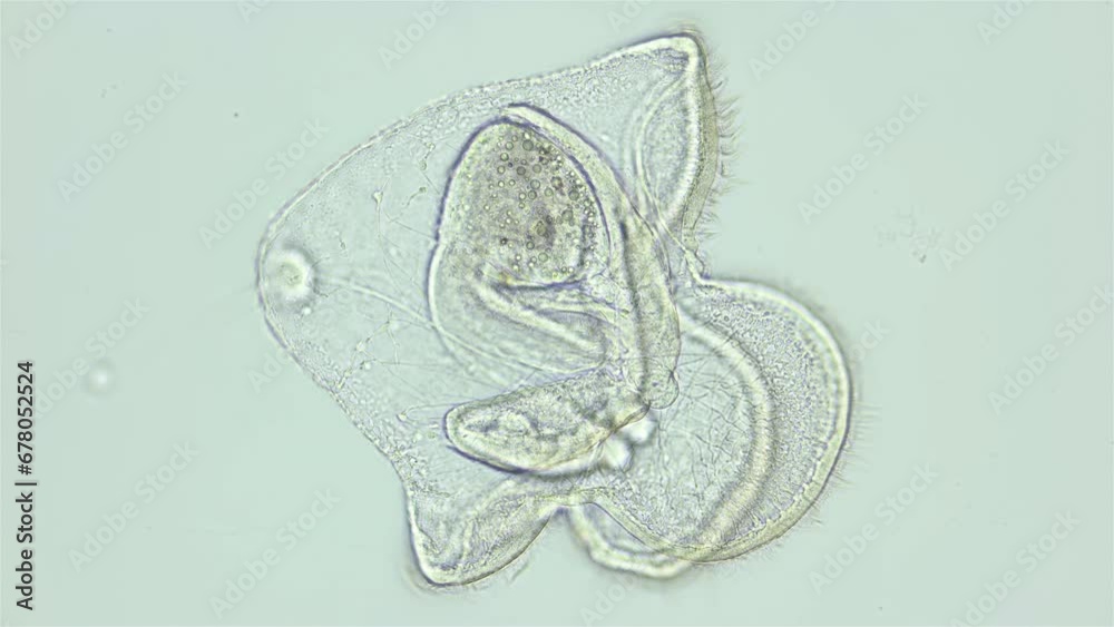 Pilidium larva of worm Heteronemertea under microscope, genus ...