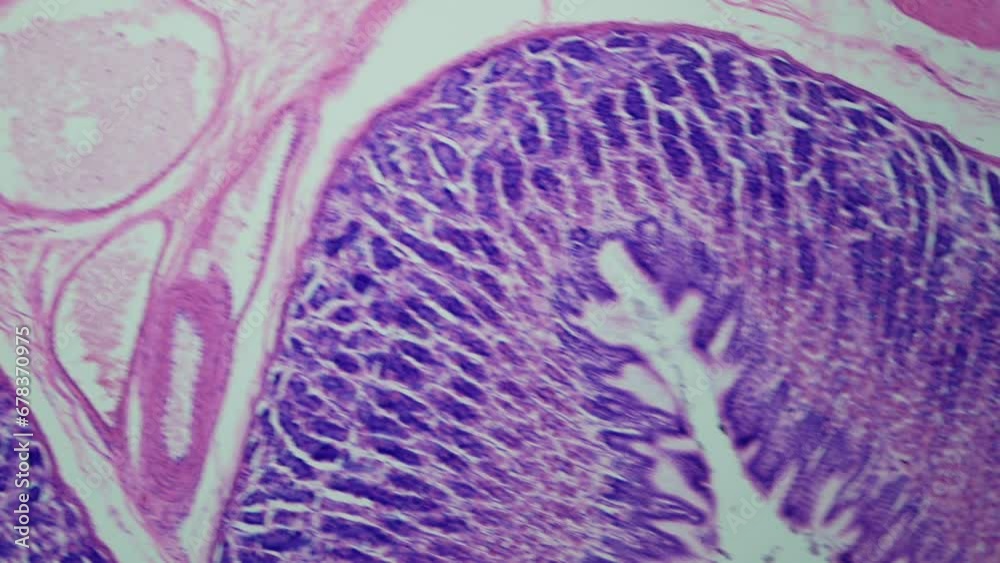 Explore human stomach intricacies under the microscope. Morphologic ...