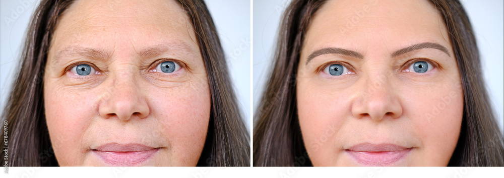 close up part of mature woman 50 years old, human face, wrinkles around ...