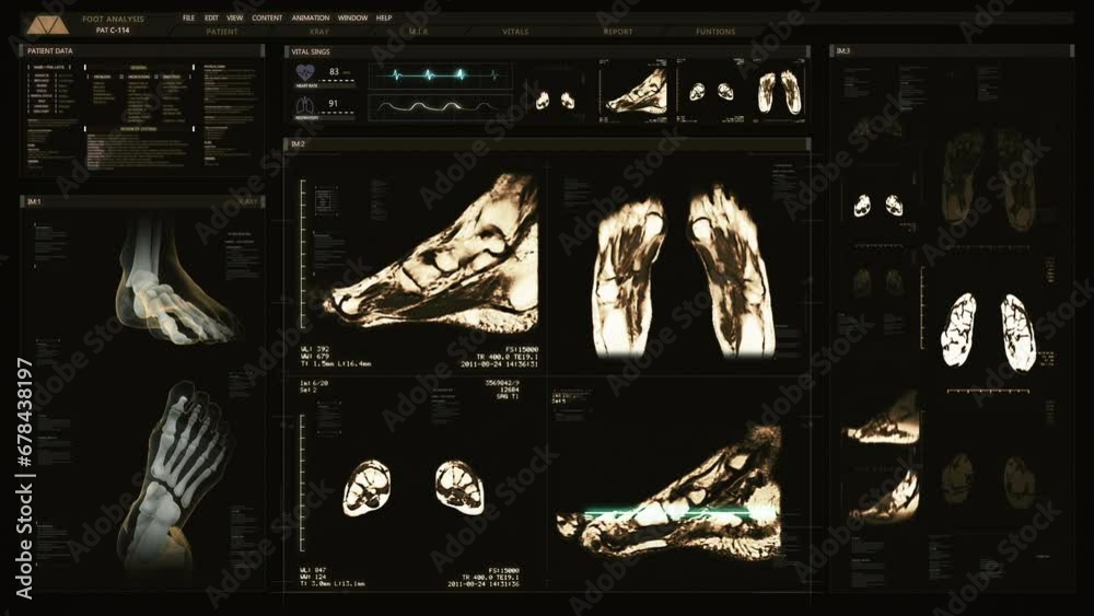 Medical Profile of Patient Showing Several Views of Foot MRI Scan ...