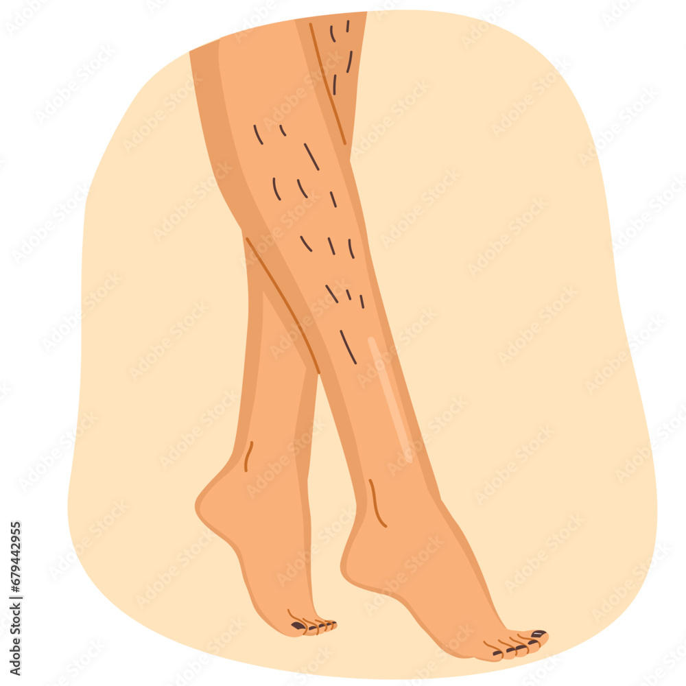 Unshaved hairy female legs vector illustration. Body positive normalize ...
