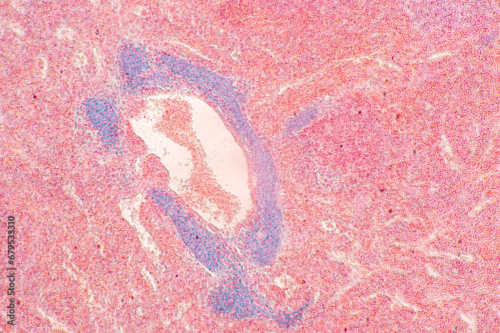 Characteristics Tissue of Thyroid gland, Lymph gland, Larynx of human ...