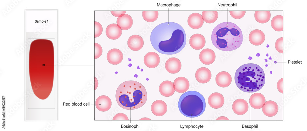 Blood smear and close up of blood cells vector. Red blood cells, white ... Blood smear and close up of blood cells vector. Red blood cells, white ...