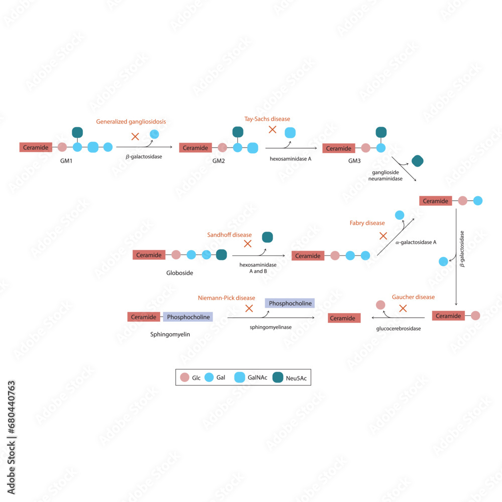 Ganglioside Tay Sachs