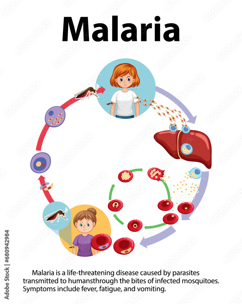 Life Cycle of Malaria Parasite: A Visual Guide Stock Vector | Adobe Stock