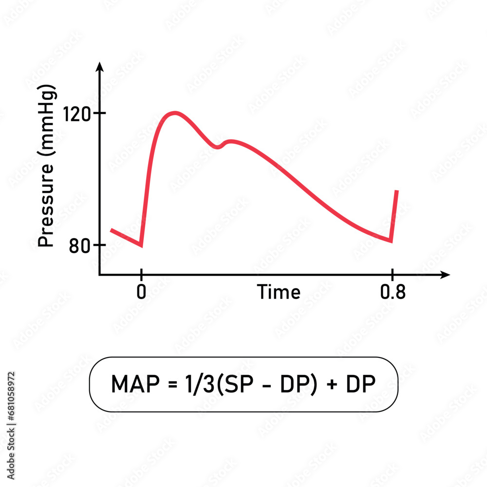 Mean arterial pressure formula. Calculating map. Diastolic blood ...