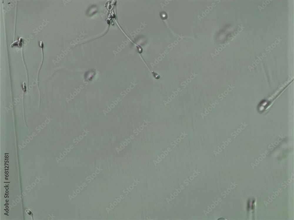 Wideo Stock: Examining the movement of the sperm cells under the ...