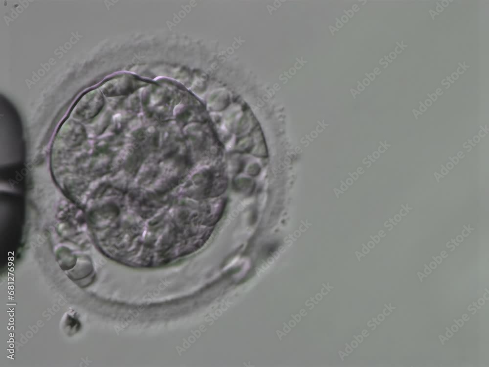 Taking a cell sample from the embryo under a microscope. Sample ...