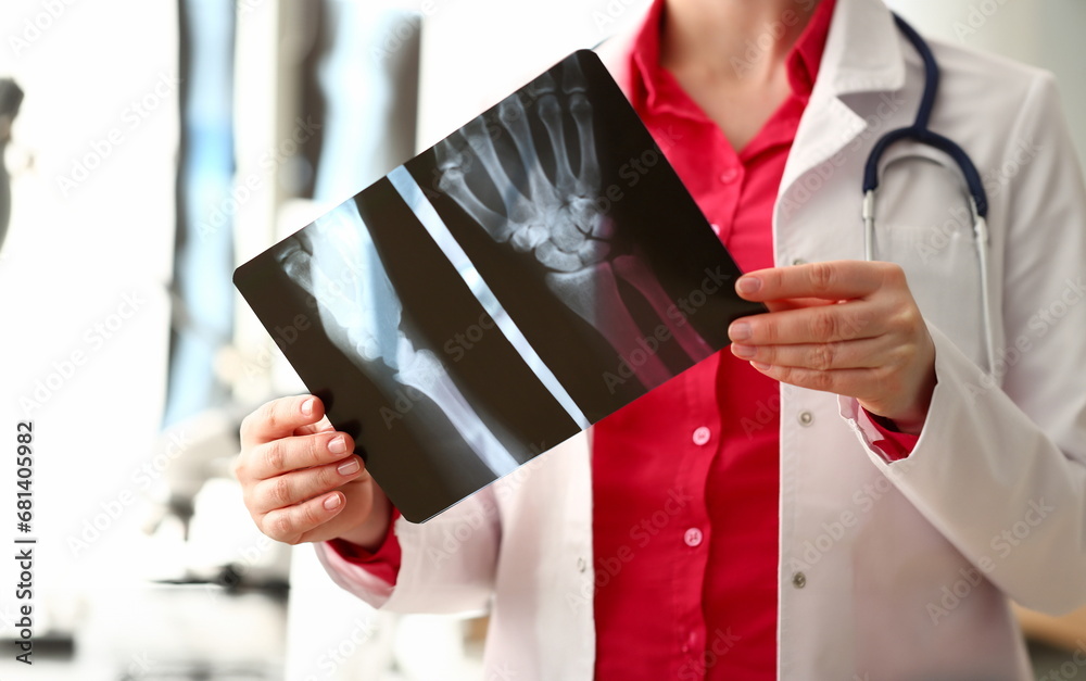 Female radiologist hold in hand x-ray film image aganist hospital ...