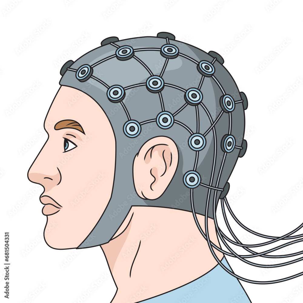 Human with electrical sensors on head for electroencephalography ...
