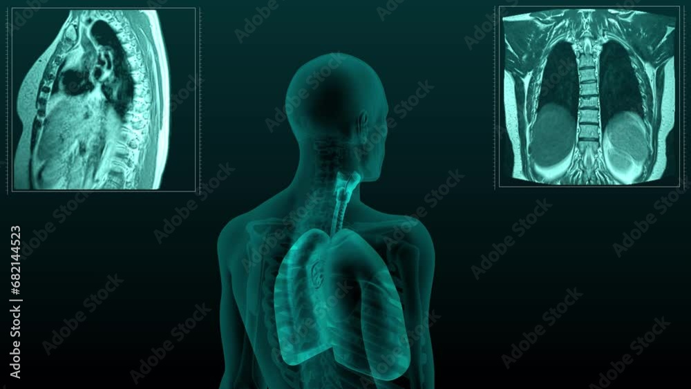 Magnetic resonance scan of the human chest with visible organs of the ...