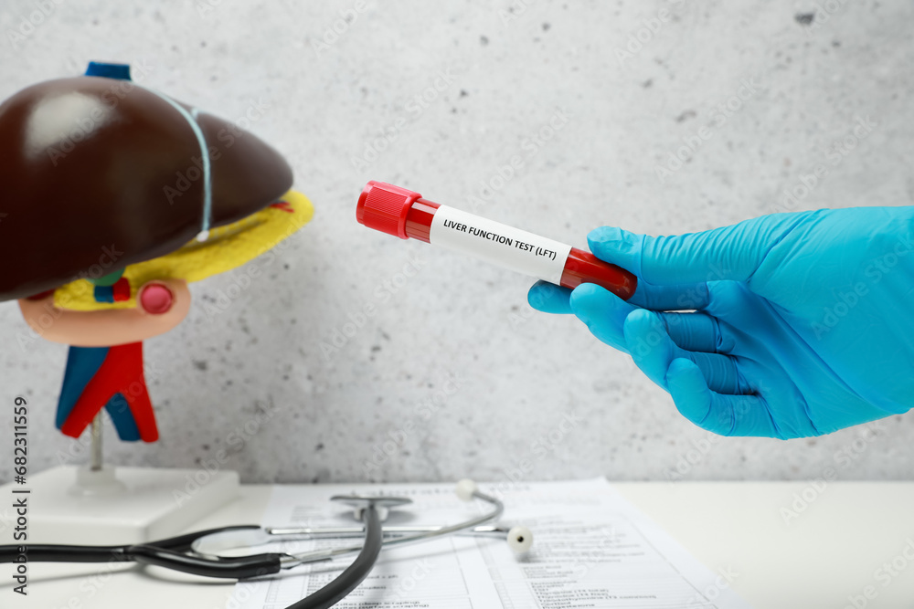 Laboratory worker holding tube with blood sample and label Liver ...