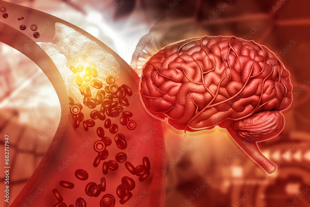 Human brain with Clogged arteries on scientific background. 3d ...