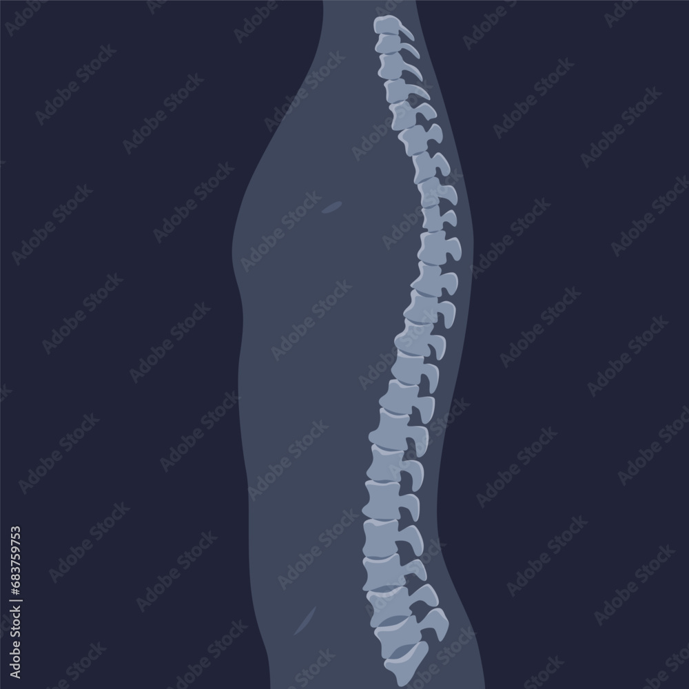 Human bones orthopedic and skeleton icon, bone x-ray image of human ...