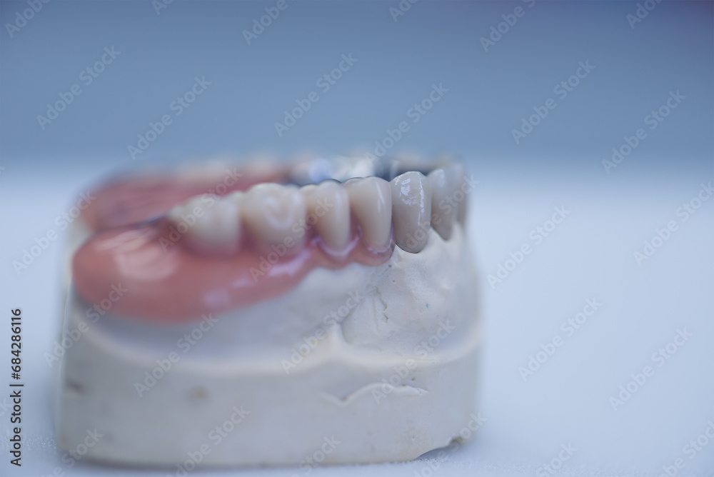 Dental teeth dentists model. Models of human jaws in an orthodontic ...