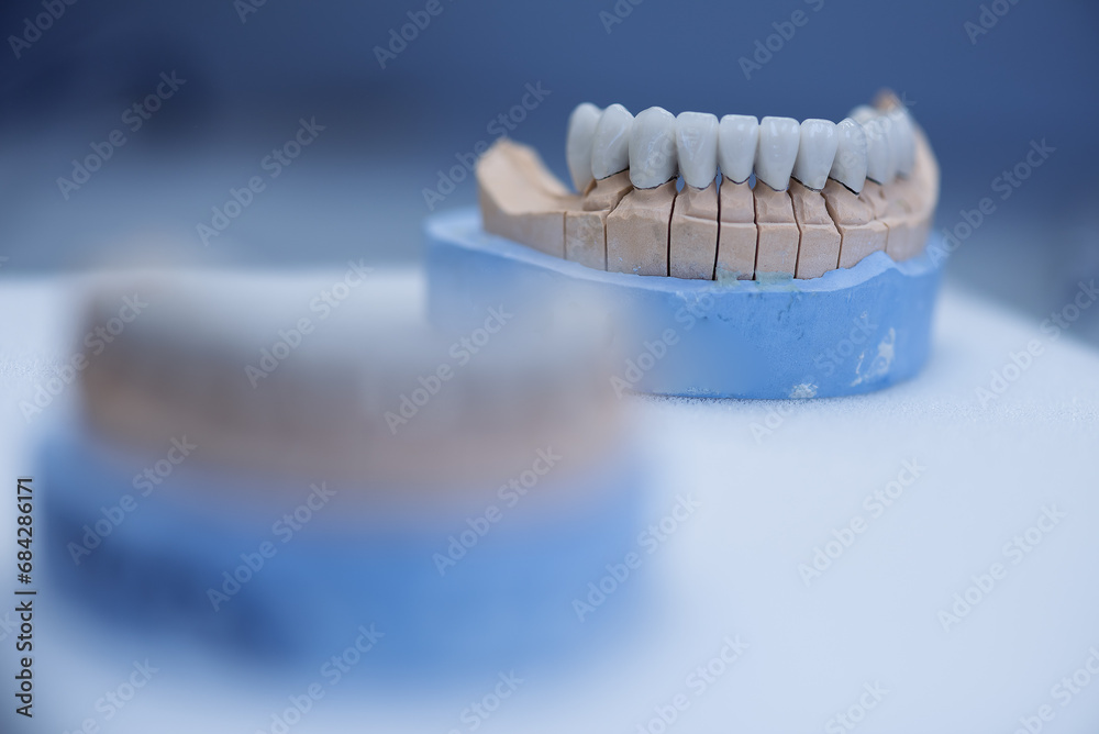 Dental teeth dentists model. Models of human jaws in an orthodontic ...