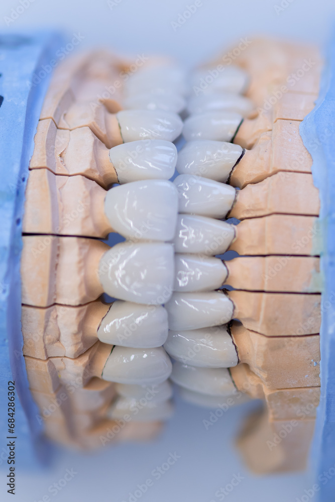 Dental teeth dentists model. Models of human jaws in an orthodontic ...