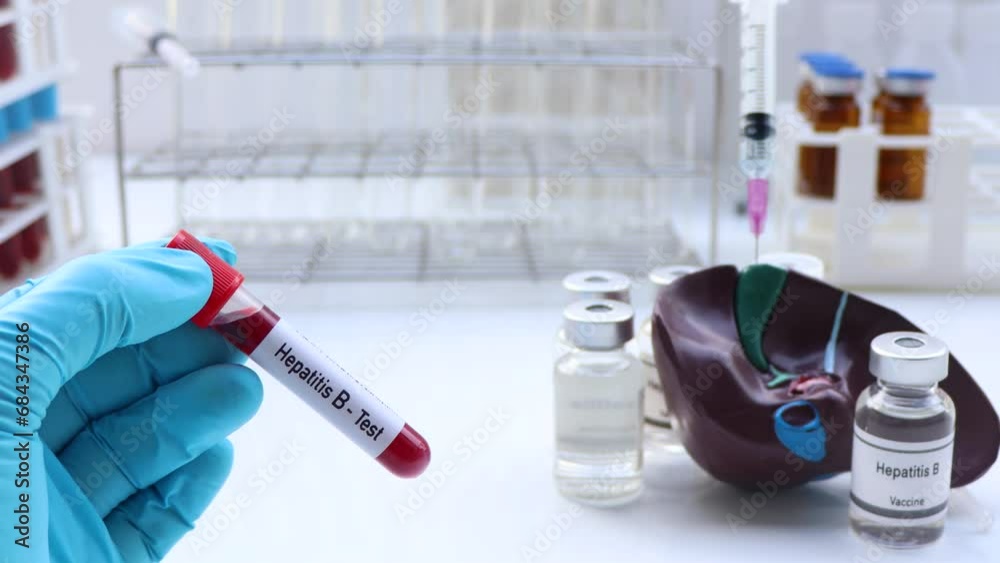 Hepatitis B test to look for abnormalities from blood, scientific ...
