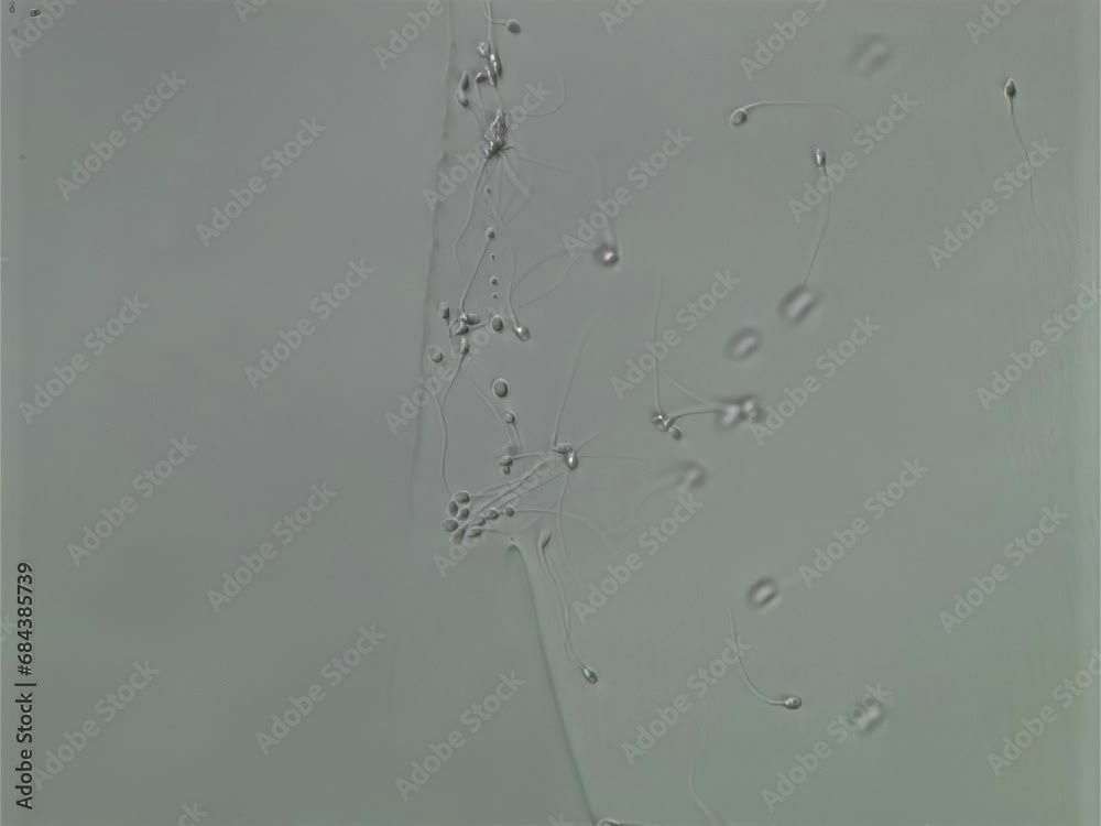 Overseeing The Sperm Cells Under The Laboratory Clinic Microscope