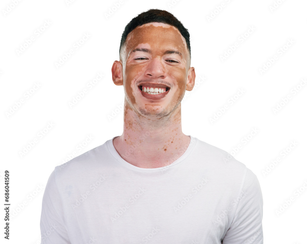 Smile, portrait and face of man with vitiligo, natural skincare or ...