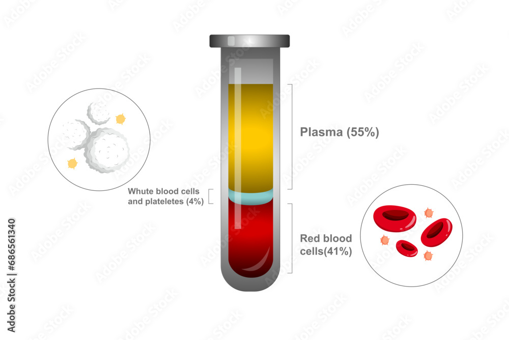 Composition of blood. Plasma, red blood cells, white blood cells and ...