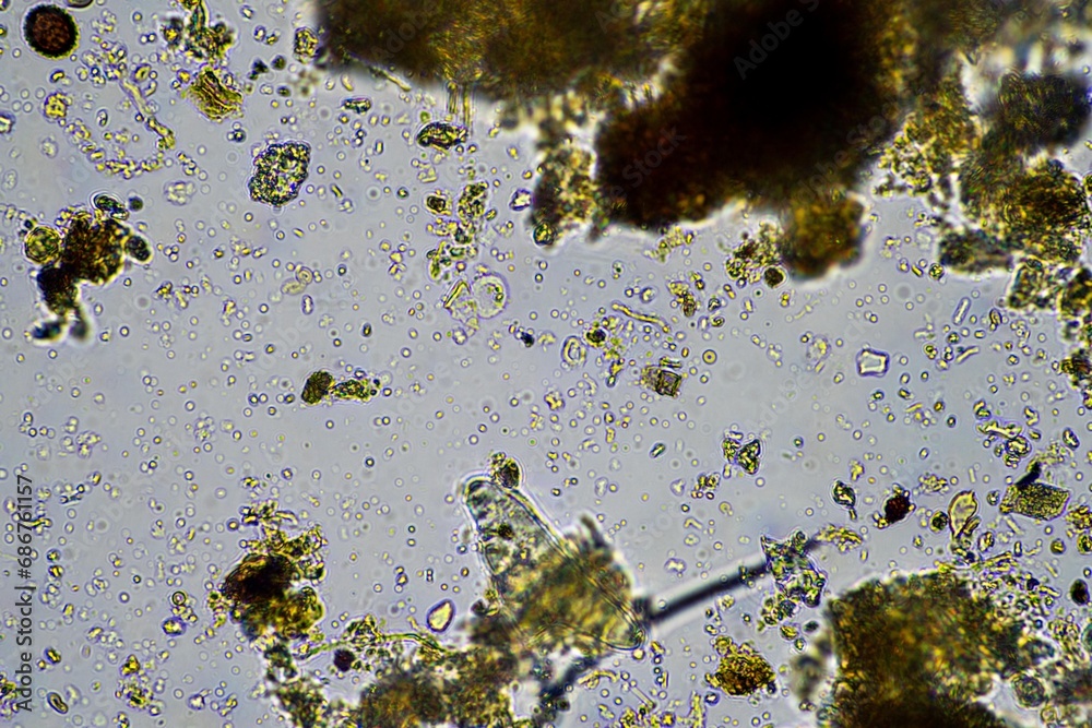 soil microorganisms close up under the microscope. in a soil samlple ...