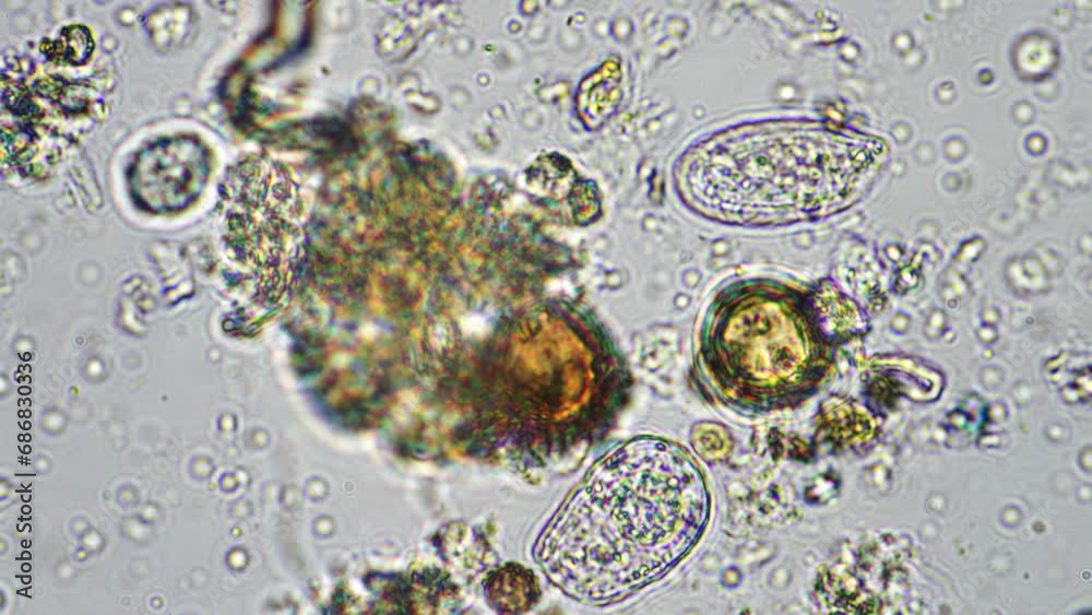 flagellates and amoeba protozoa soil microorganisms close up under the ...
