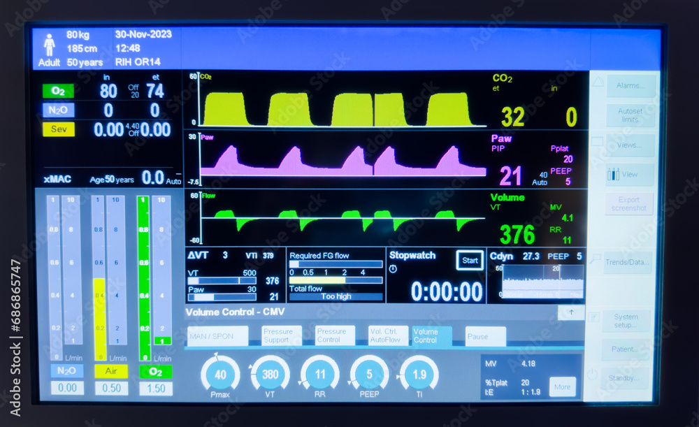 Hospital monitors display vital signs: hemodynamics, heart rate, blood ...