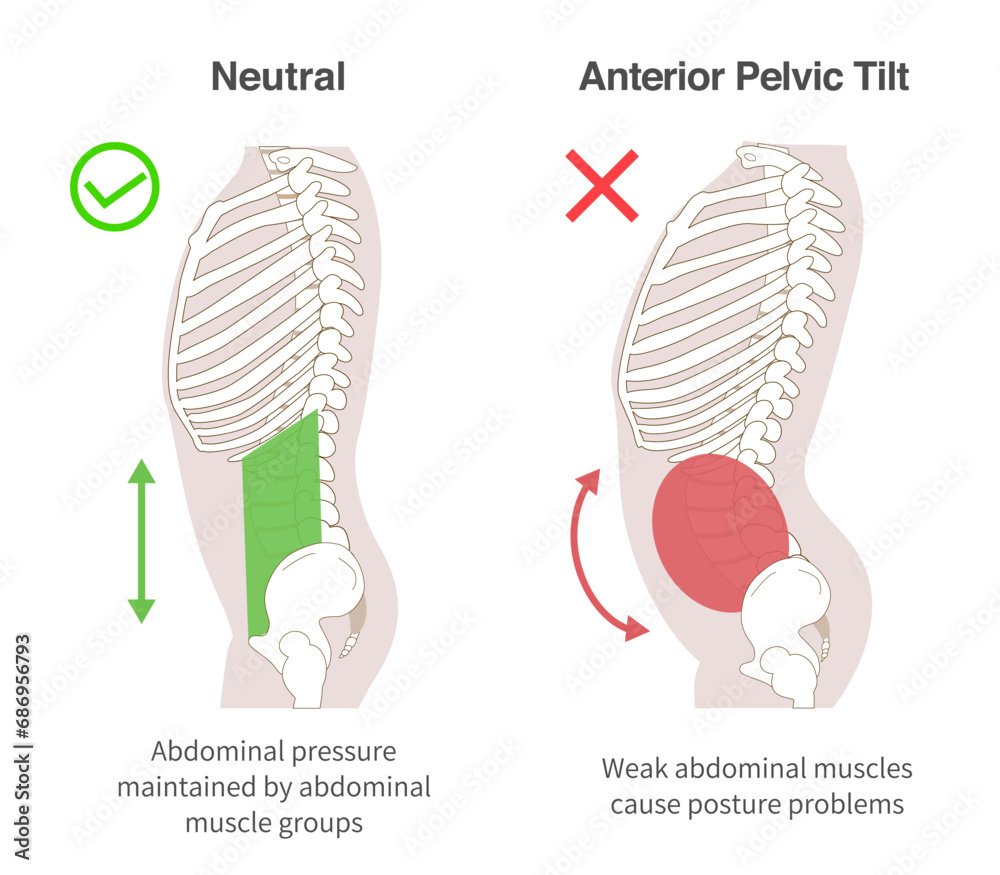 Diagrammatic illustration of the relationship between abdominal muscle ...