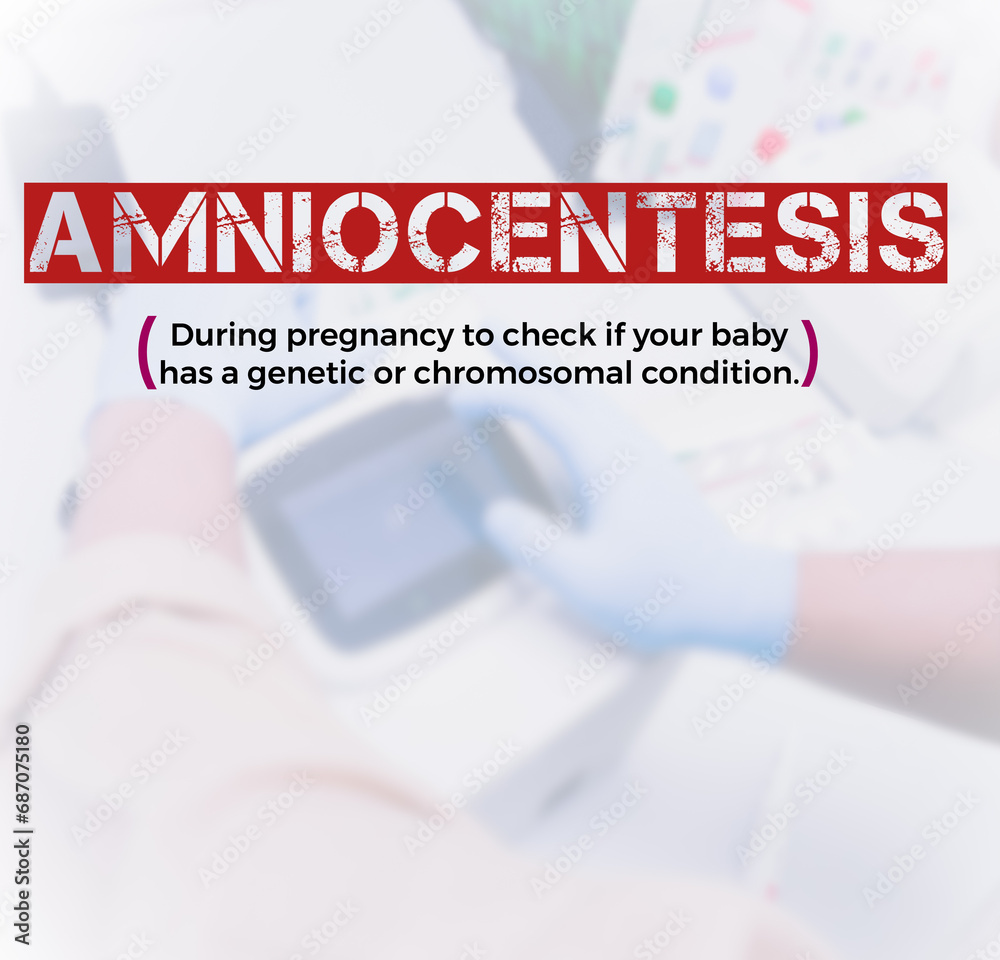 Amniocentesis (amniotic fluid test). a test done during pregnancy (15 ...