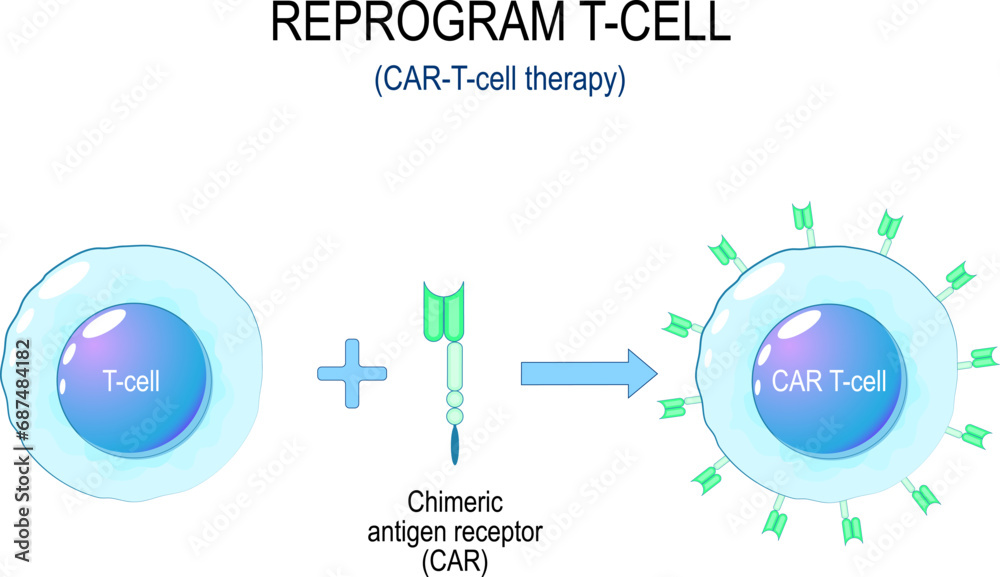 Poster CAR-T-cell cancer therapy. Process of a T cell reprogramming ...