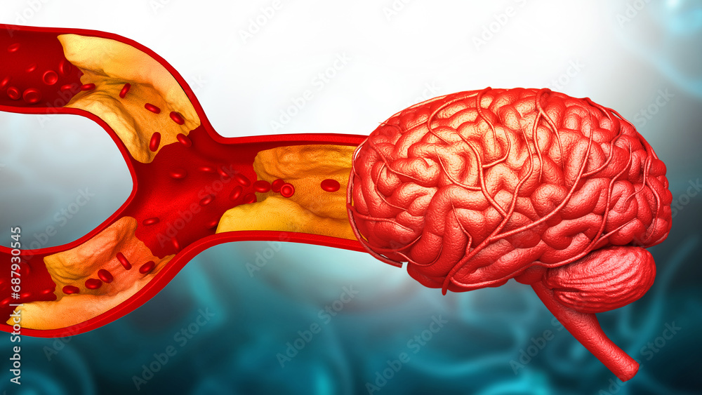 Human brain with Clogged arteries on scientific background. 3d ...