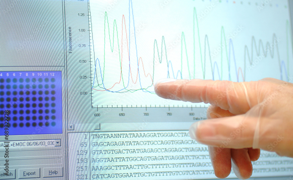 Sequencing of human DNA in a computer screen at a hospediatric research ...