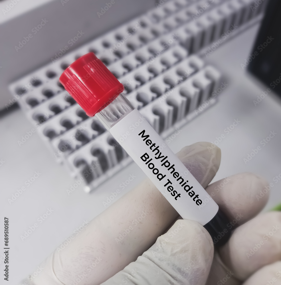 Blood sample for Methylphenidate or Retalin test. Stimulant used for ...