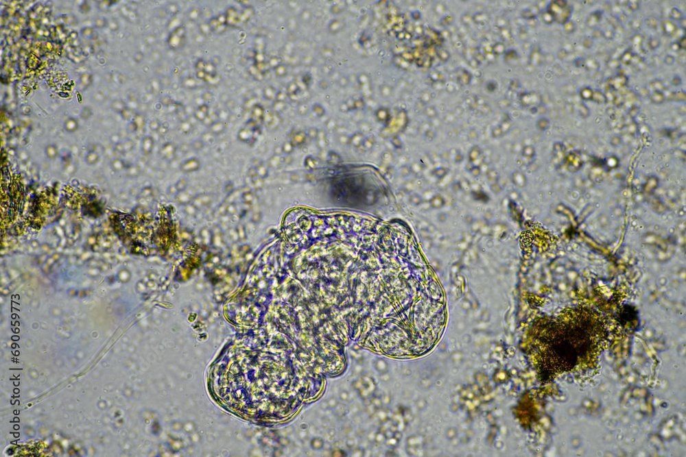 microorganisms and a tardigrade in a soil sample on a farm under the ...