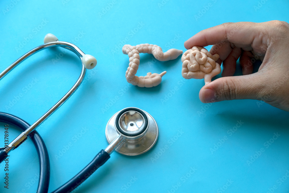 Concept of Colonic disease,Irritable bowel syndrome,Large Intestine ...