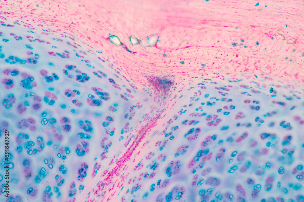 Anatomy and Histological Rea Bone marrow Human, Hyaline cartilage human ...
