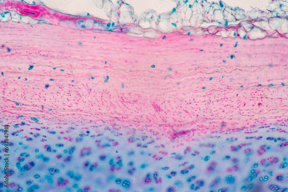 Anatomy and Histological Rea Bone marrow Human, Hyaline cartilage human ...