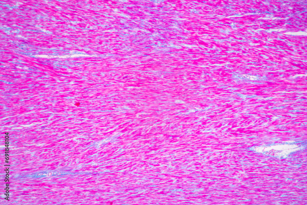 Anatomy and Histological Rea Bone marrow Human, Hyaline cartilage human ...