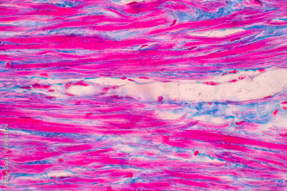 Anatomy and Histological Rea Bone marrow Human, Hyaline cartilage human ...