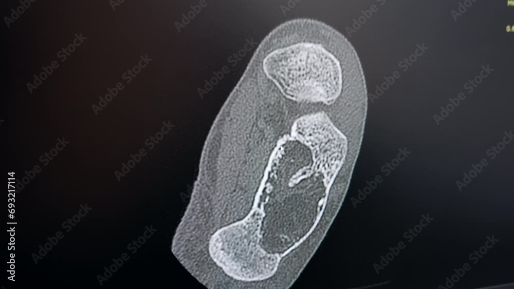 Closer look at the MRI scan of a body part on the black screen ...