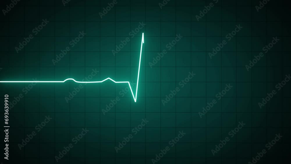 Glowing light blue neon heartbeat pulse rate line. Health and Medical ...