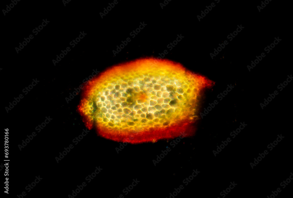 Cross section of the stem of a moss, with polarization. Stock Photo ...