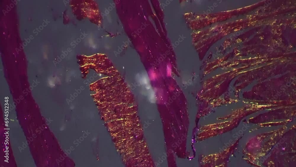 Tongue in longitudinal section showing filiform papillae under ...