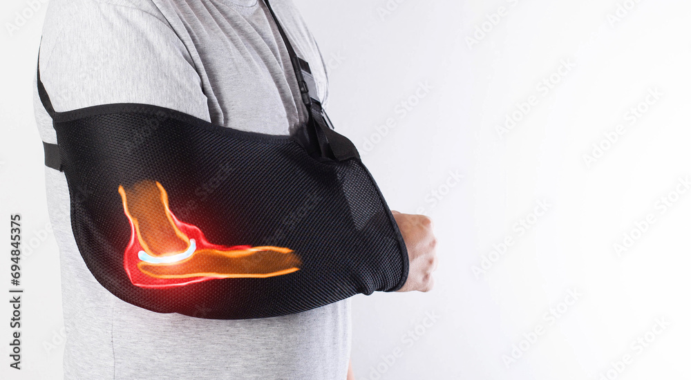 A man's arm in a black bandage for immobilization of the elbow joint ...