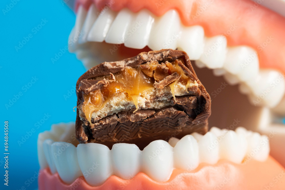 A bitten piece of chocolate in a dental jaw mockup on a blue background ...