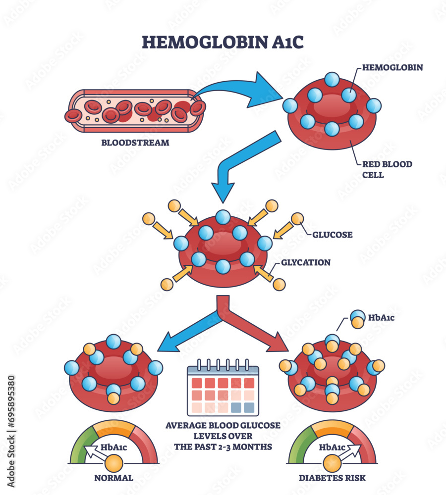 Poster Hemoglobin A1C or HbA1c test for sugar level in bloodstream ...