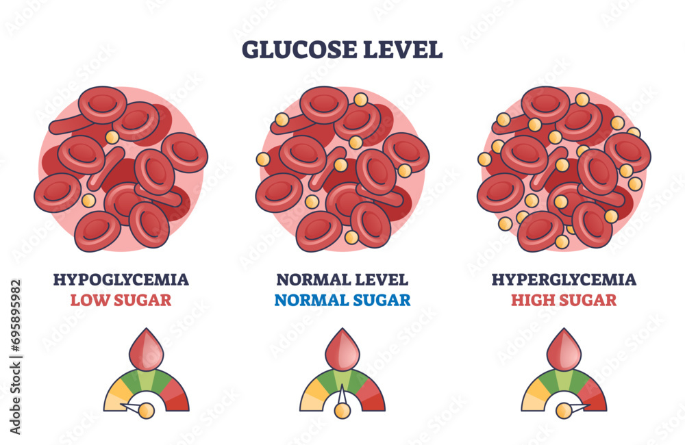 Glucose level with low, normal and high sugar in blood outline diagram ...