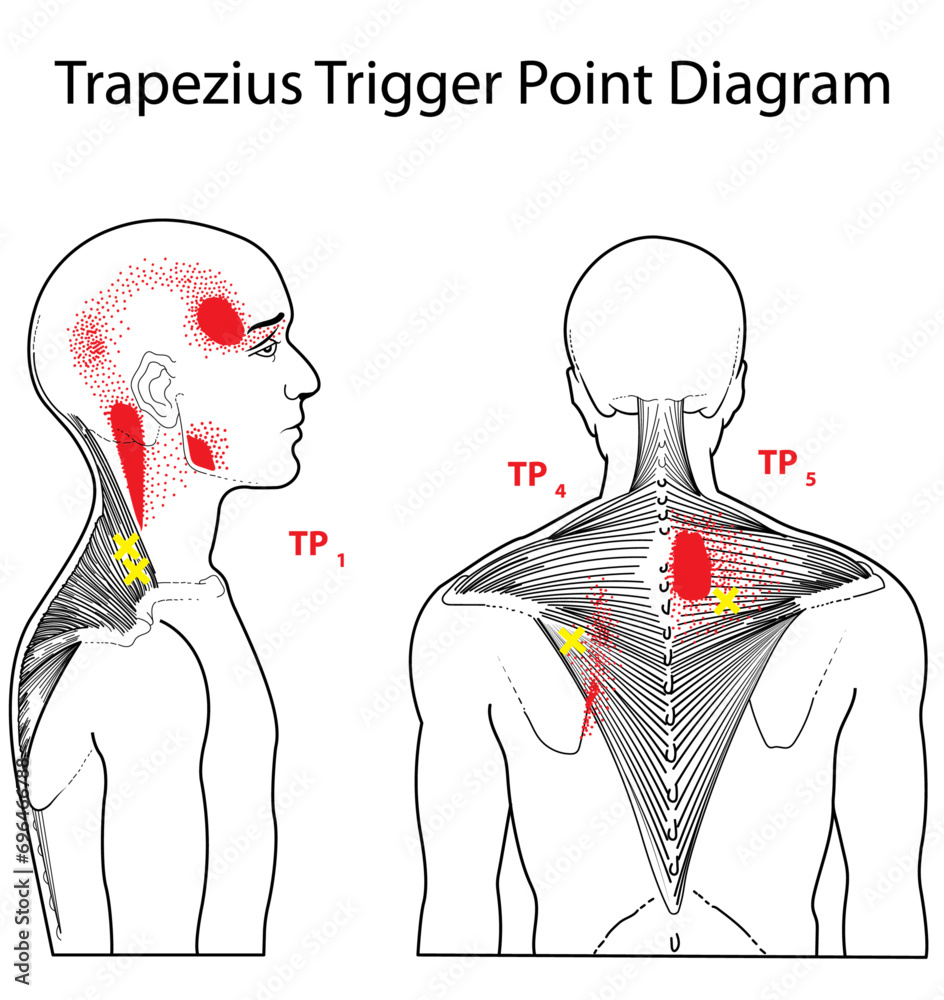 Poster Trapezius Trigger Point Diagram Vector – Zidna Slika | Europosteri