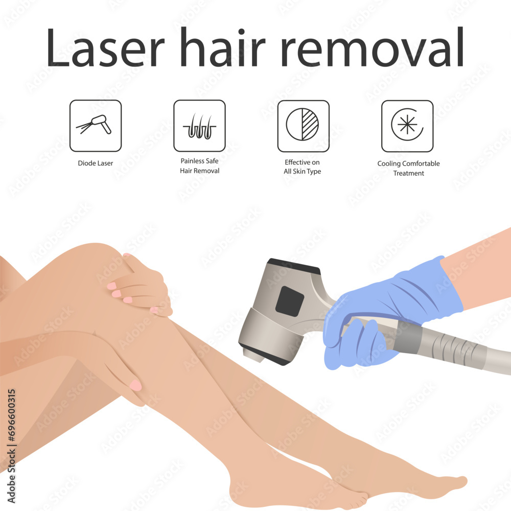 Laser hair removal of the skin layer and follicle for beauty and ...